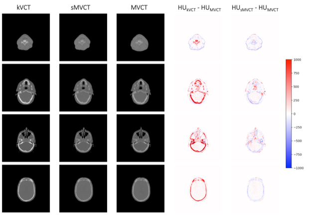 Using CycleGAN Machine Learning to Improve Accuracy of Photon and ... Using CycleGAN Machine Learning to Improve Accuracy of Photon and ...